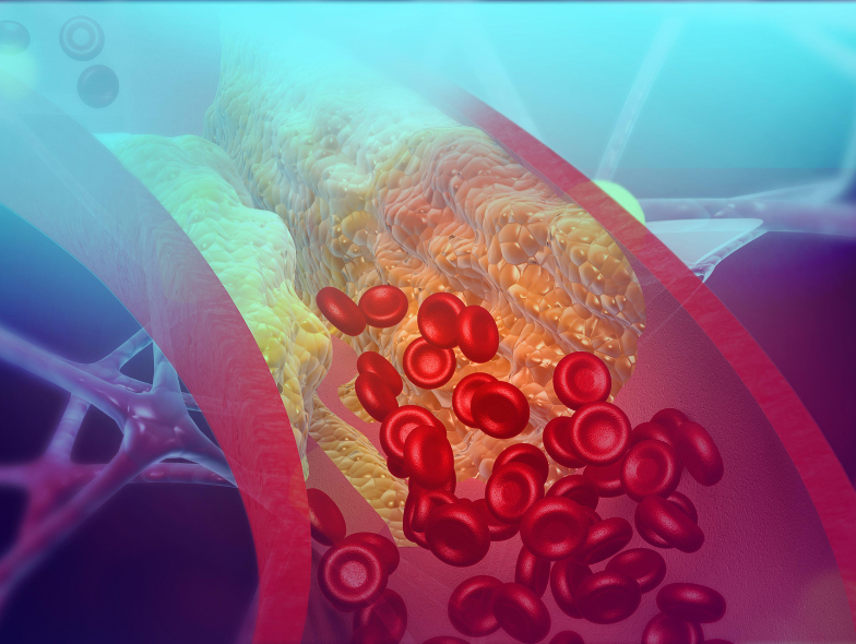 Coronary drug-coated medical device receives US FDA approval | CPHI Online